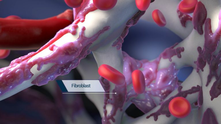 BIOBRACE TECHNOLOGY - XVIVO