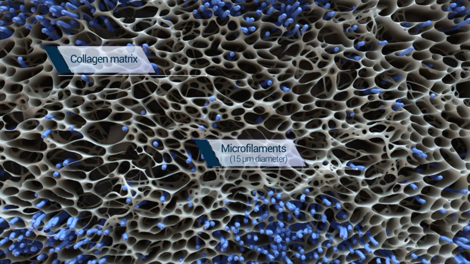 BIOBRACE TECHNOLOGY - XVIVO