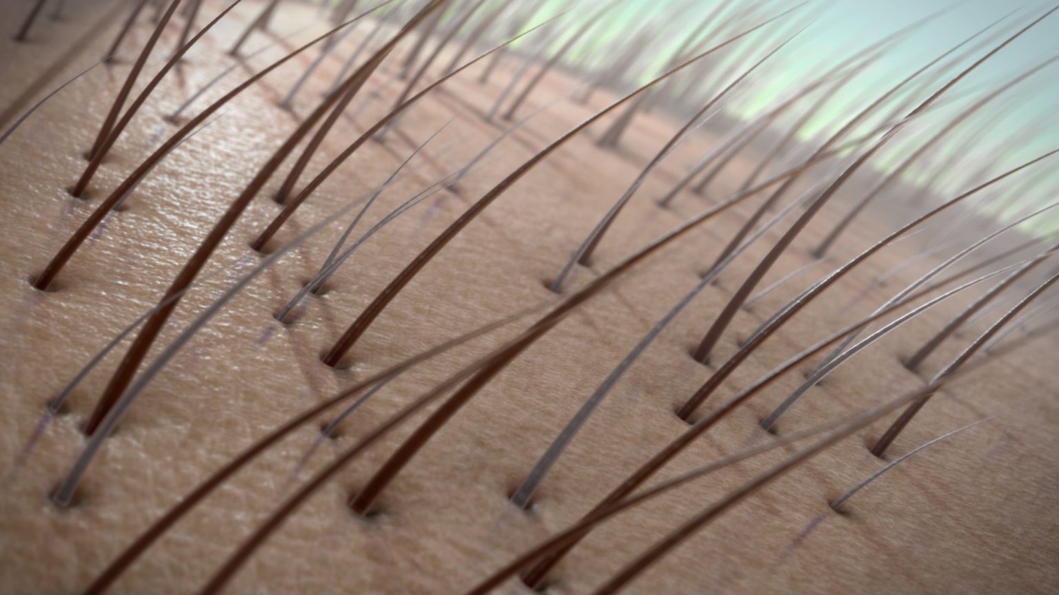 Baldness Cartoon & Hair Loss Animation | XVIVO